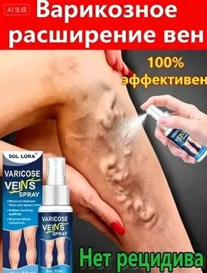 Спрей от варикоза, 60мл , эффективен при сосудистых звездочках, тромбозе, фитокрем для укрепления сосудов, вен, от тяжести ног, венозные воспаления и облегчает состояние при варикозе