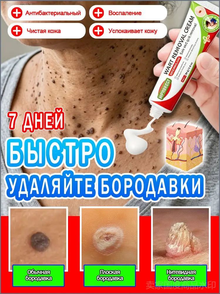 Мазь от папиллом и бородавок для удаления на ногах и теле, также от сухих мозолей, безболезненно, не оставляет следов 30 г.