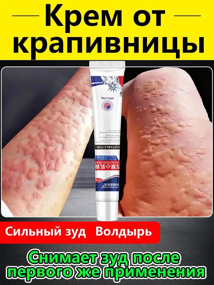 Мазь от крапивницы, Используется для лечения симптомов дерматита, крапивницы, экземы, зуда кожи, китайская чудо-мазь,20 г