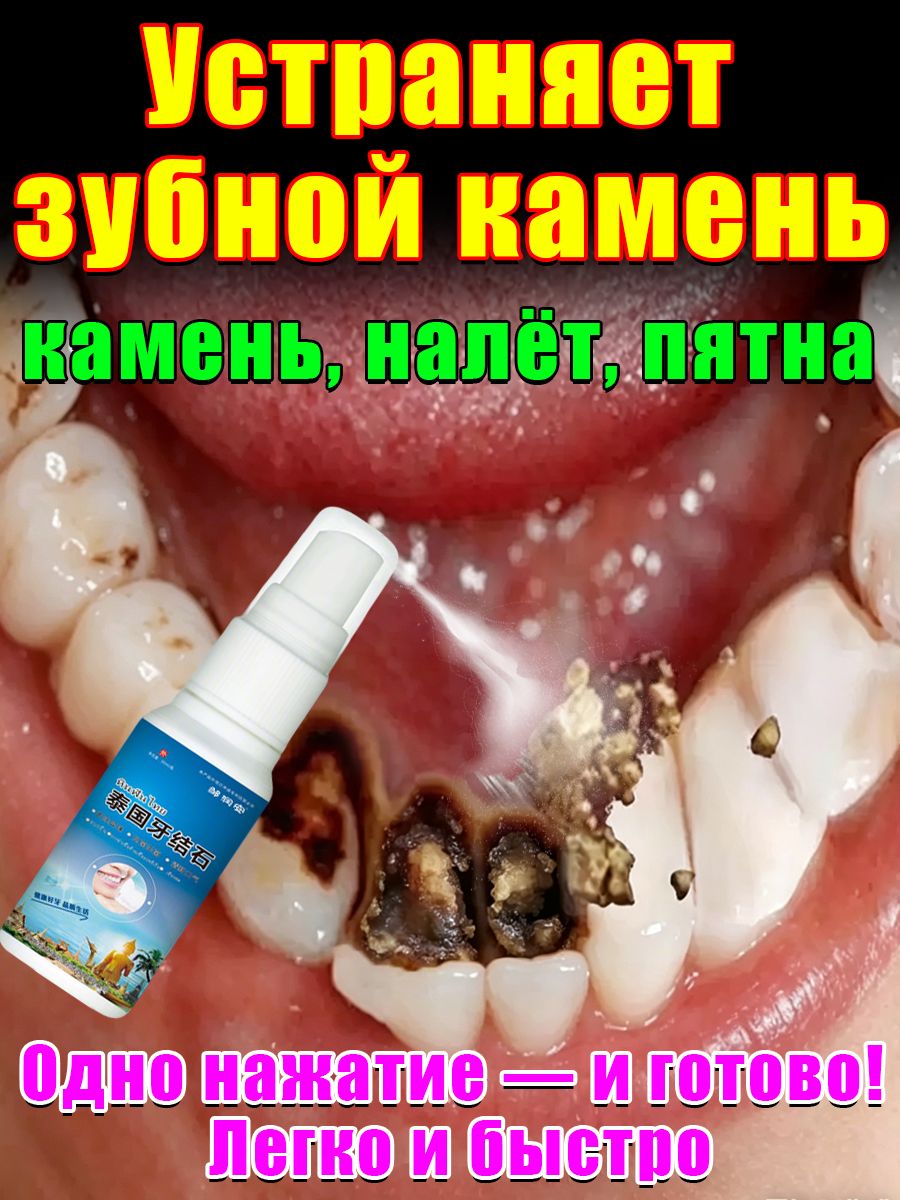 Спрей для очистки камня зубов, Артикул: 5233360172, Спреи для полости рта
