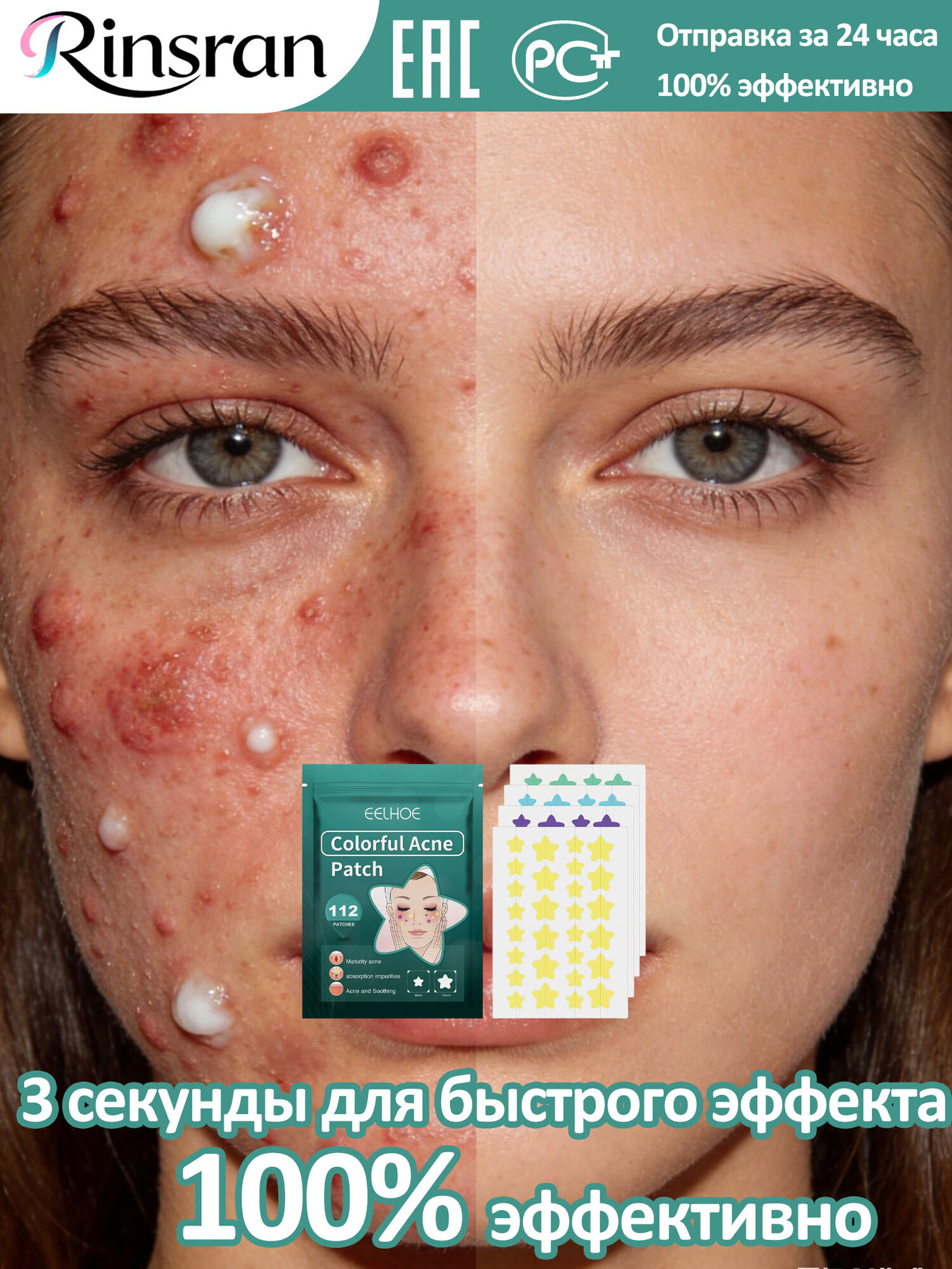 Патчи от прыщей гидроколлоидные / наклейки от прыщей в виде звездочек