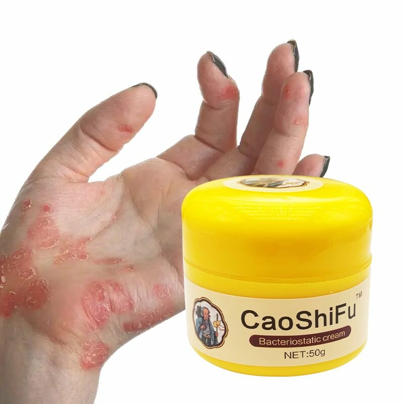 CAOSHIFU Антибактериальный крем для кожи, 50 г, большая емкость. Мазь от псориаза, дерматита, зуда кожи и экземы, для проблемной кожи на теле.