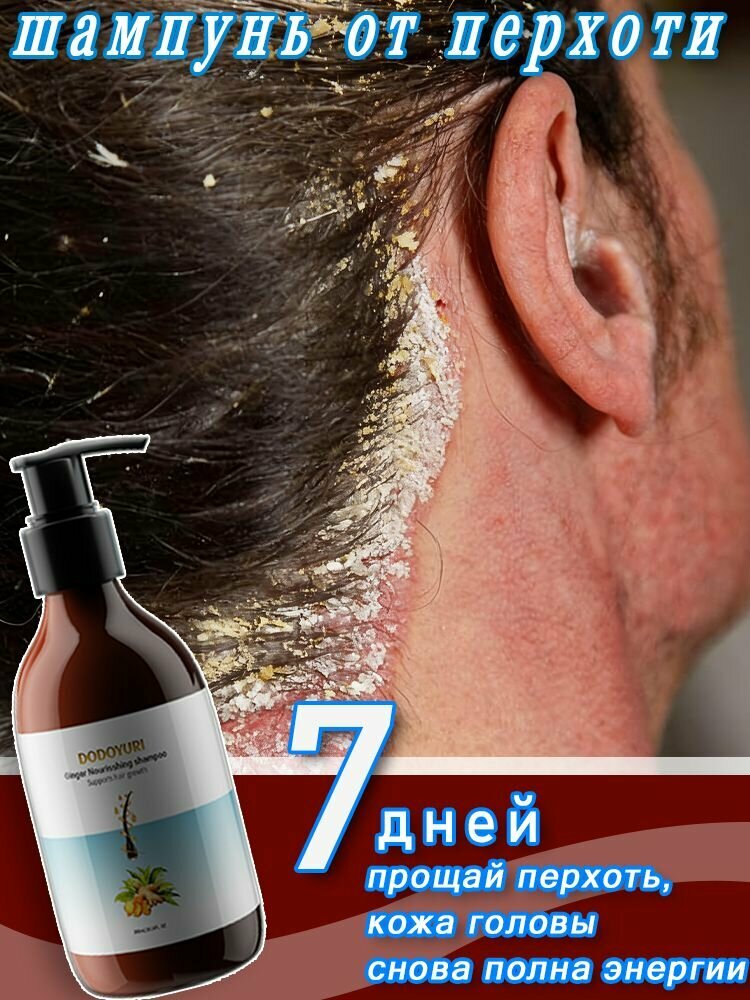 Шампунь с имбирем от перхоти, профилактика себорейного дерматита, остановка зуда и выпадения волос, для жирной кожи головы, 300 мл