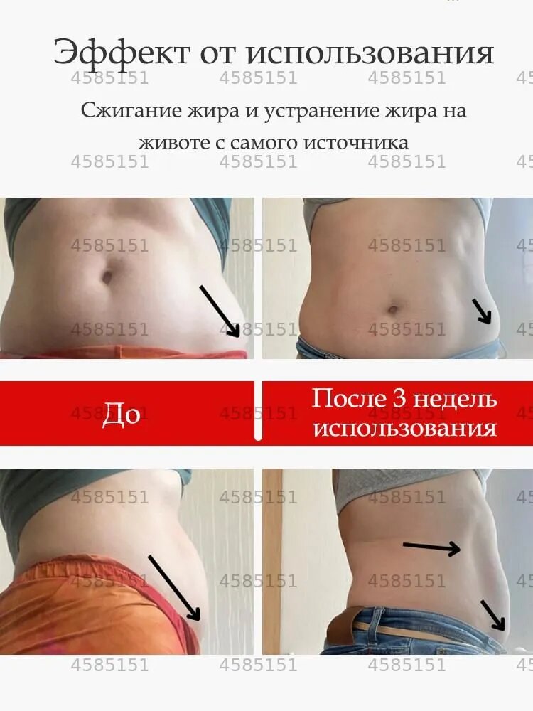 Средство антицеллюлитное — фото 1