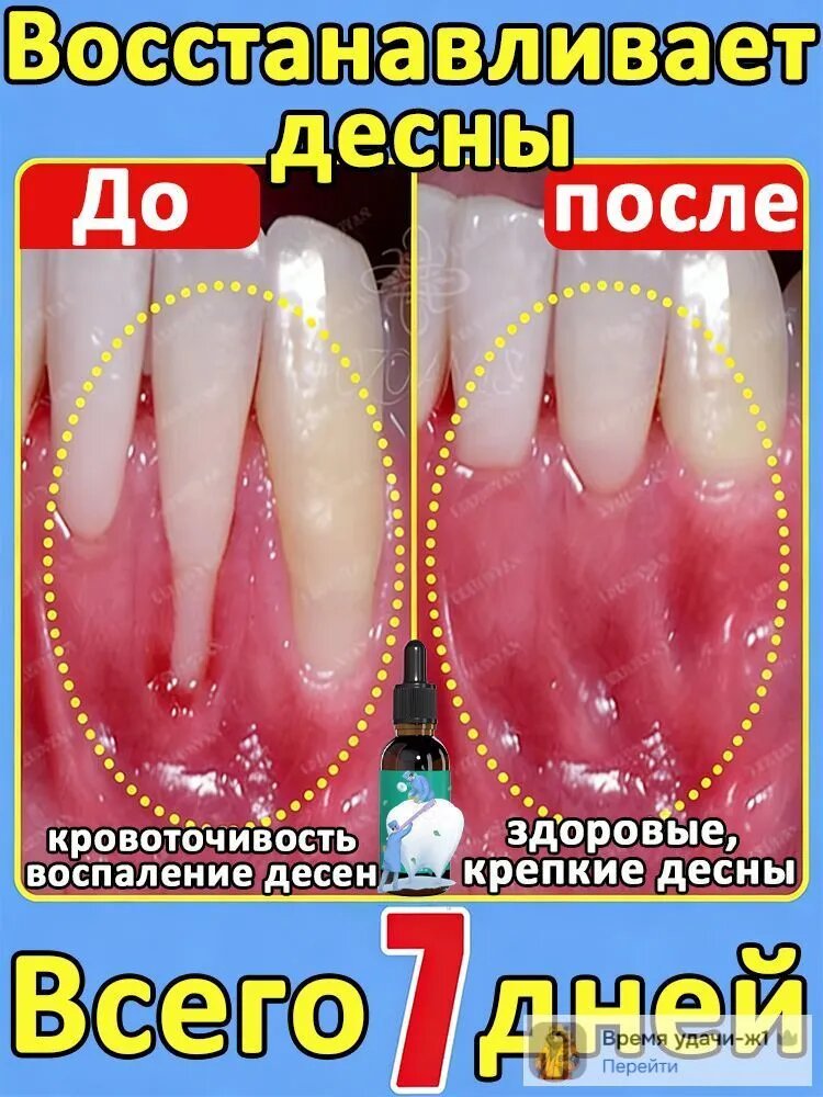 Ополаскиватель для полости рта 30.11 мл