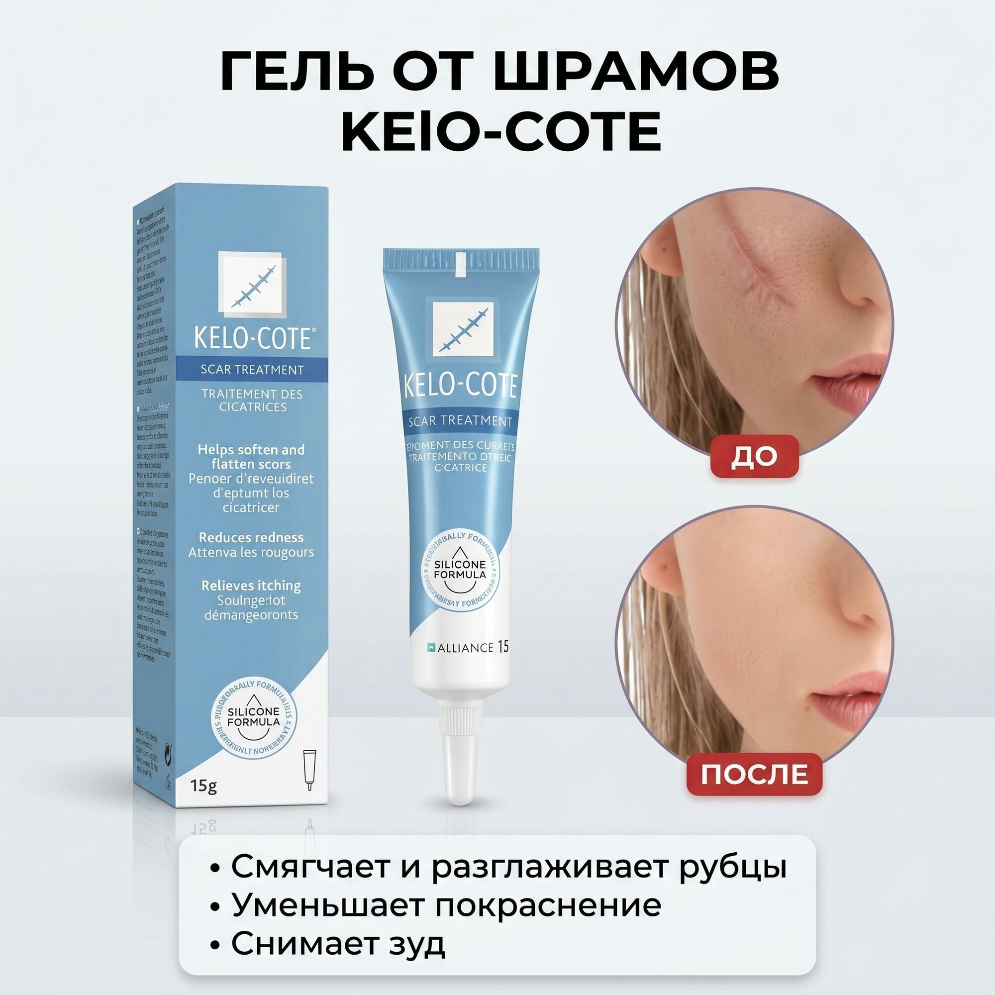 Kelo-Cote гель для уменьшения выраженности и профилактики образования рубцов и шрамов 15 г