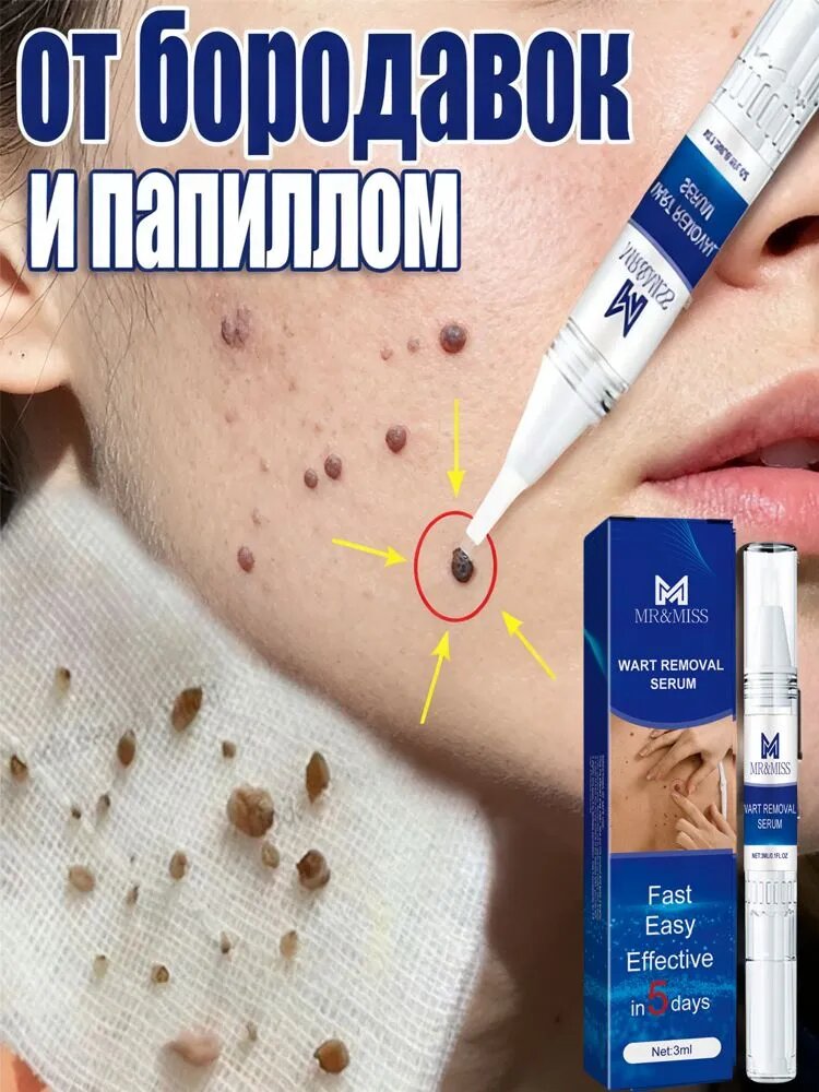 MR&MISS карандаш от папиллом и бородавок 3 мл, папиллом и родинок без боли и следов. Без побочных эффектов