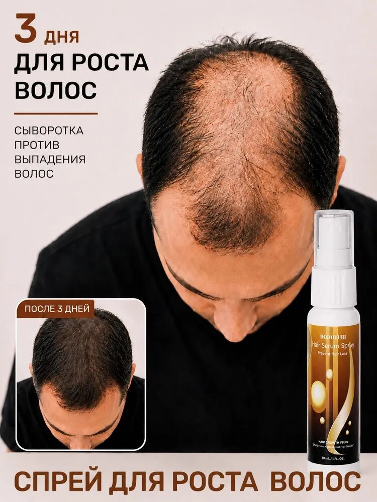 Спрей для роста волос, подходит для мужчин и женщин, укрепляет корни и волосяные фолликулы, уменьшает выпадение и ломкость, содержит натуральные растительные ингредиенты, 30 мл