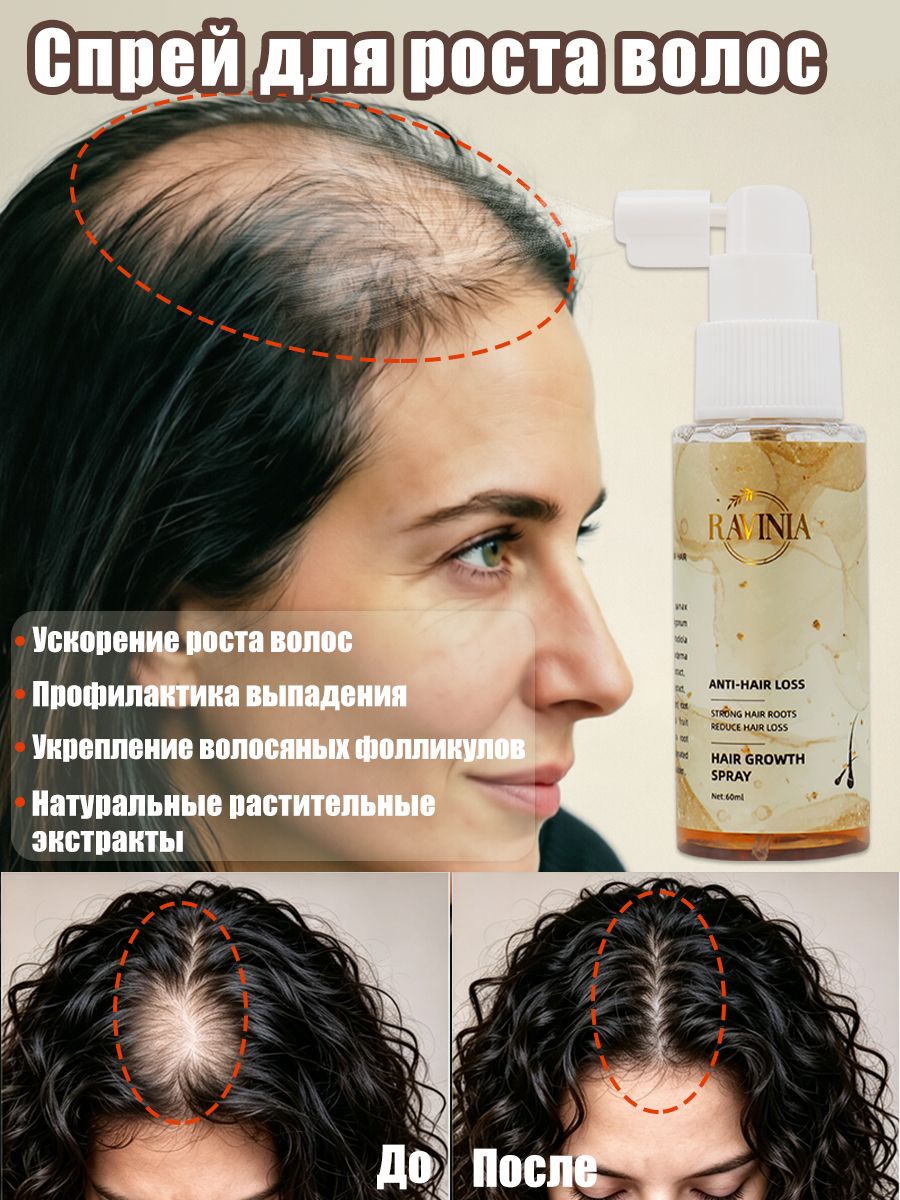 RAVINIA Спрей для роста волос. Плотность волос +500%, профессиональный спрей против выпадения, натуральный состав, без добавок, 60 мл