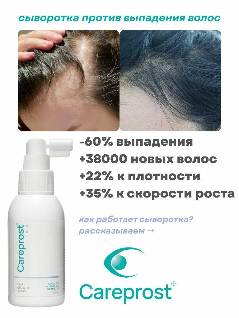 Сыворотка против выпадения и для роста волос Careprost (Карепрост), Капиксил 5%, Реденсил 3%, Байкапил 2%