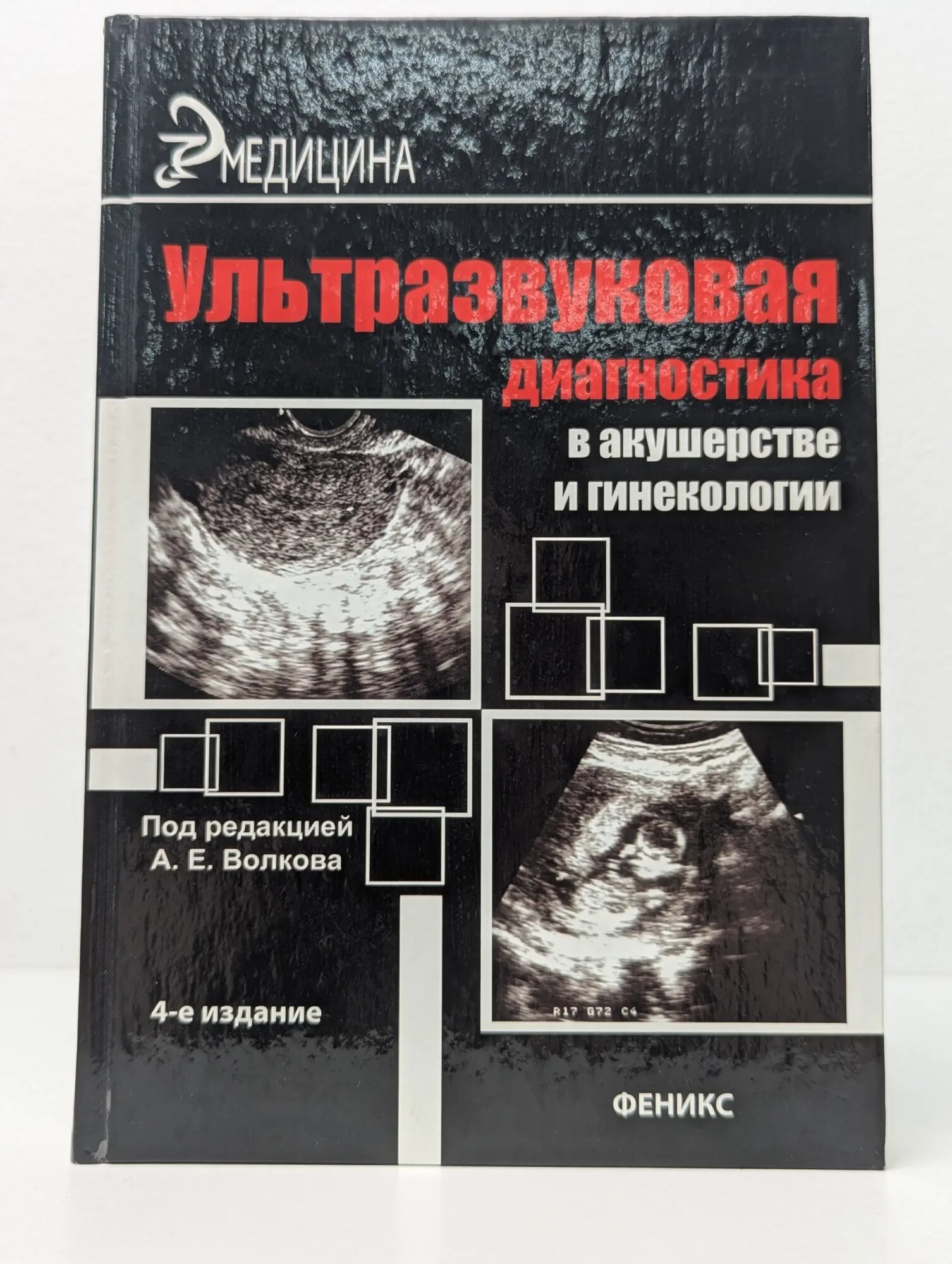 Ультразвуковая диагностика в акушерстве и гинекологии Сборник 2013