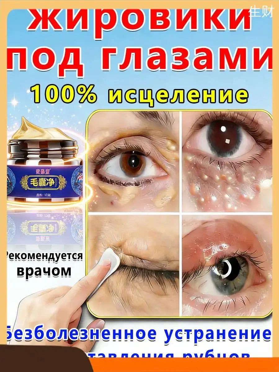 Мазь от жировики под глазами Милиумы Просянка, 30 r