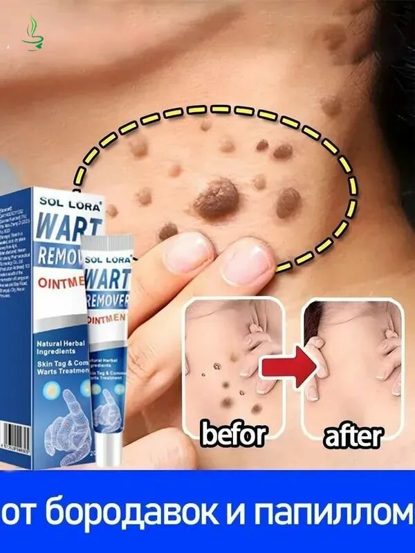 Мазь от бородавок, Крем средство для удаления бородавок, папиллом и родинок, безболезненно, мозолей на теле и лице Чистотел, 20г