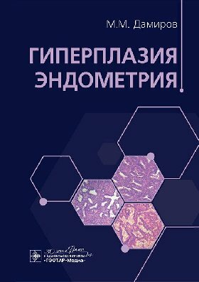 Гиперплазия эндометрия / Дамиров М. М.