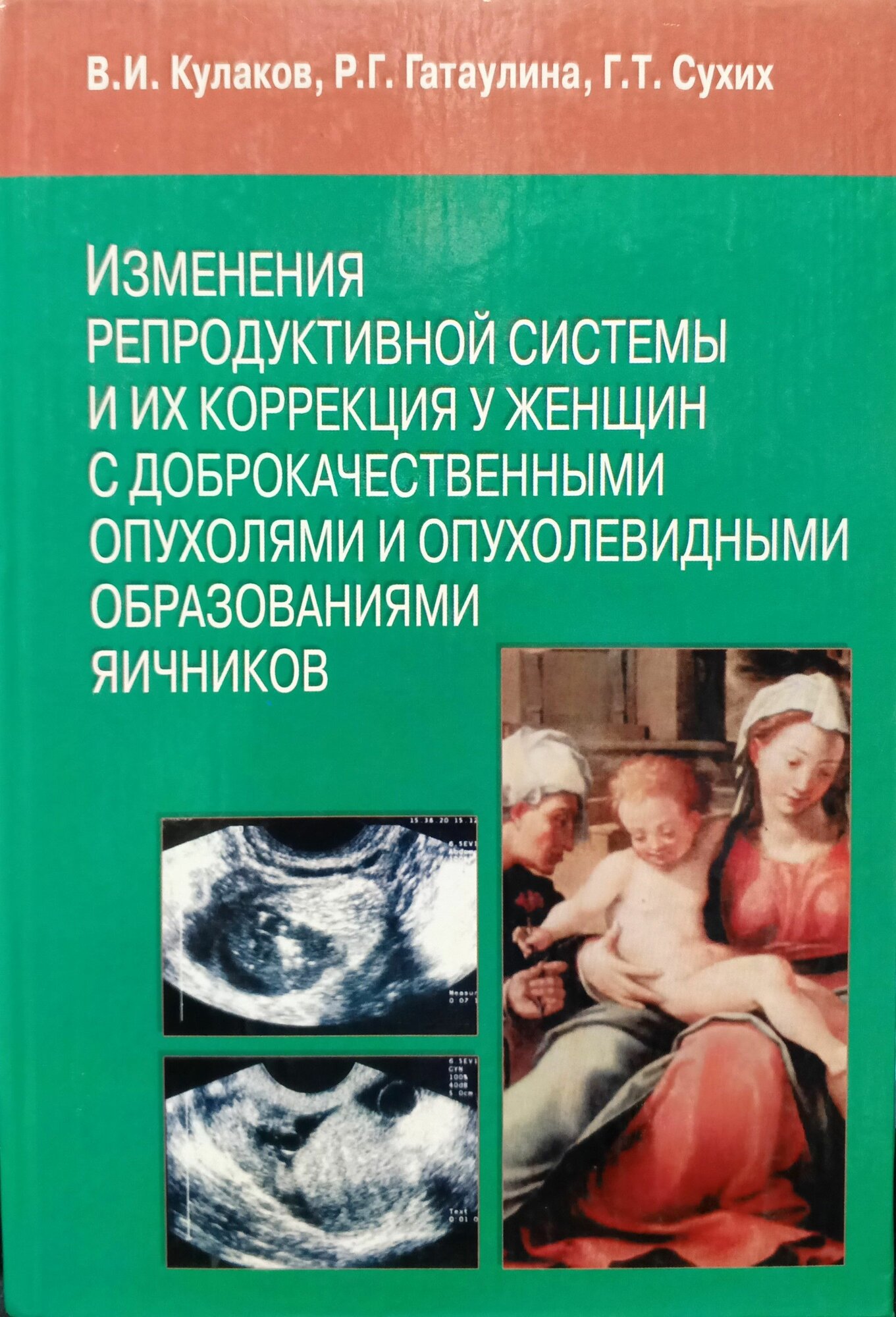 Изменения репродуктивной системы и их коррекция у женщин с доброкачественными опухолями и опухолевидными образованиями яичников