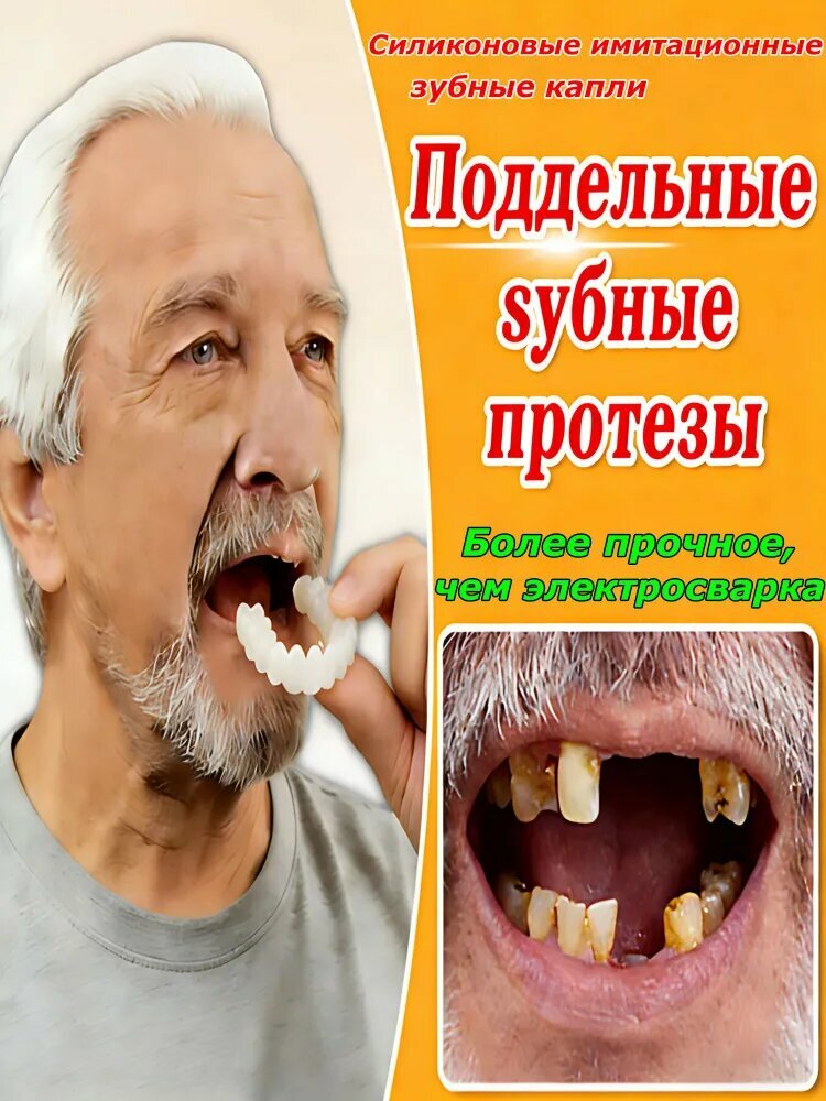 Виниры для зубов накладные верхние и нижние