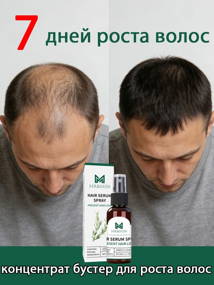 MR&MISS cыворотка для роста волос и бороды, средство против выпадения и для роста волос, Подходит для мужчин и женщин 50мл