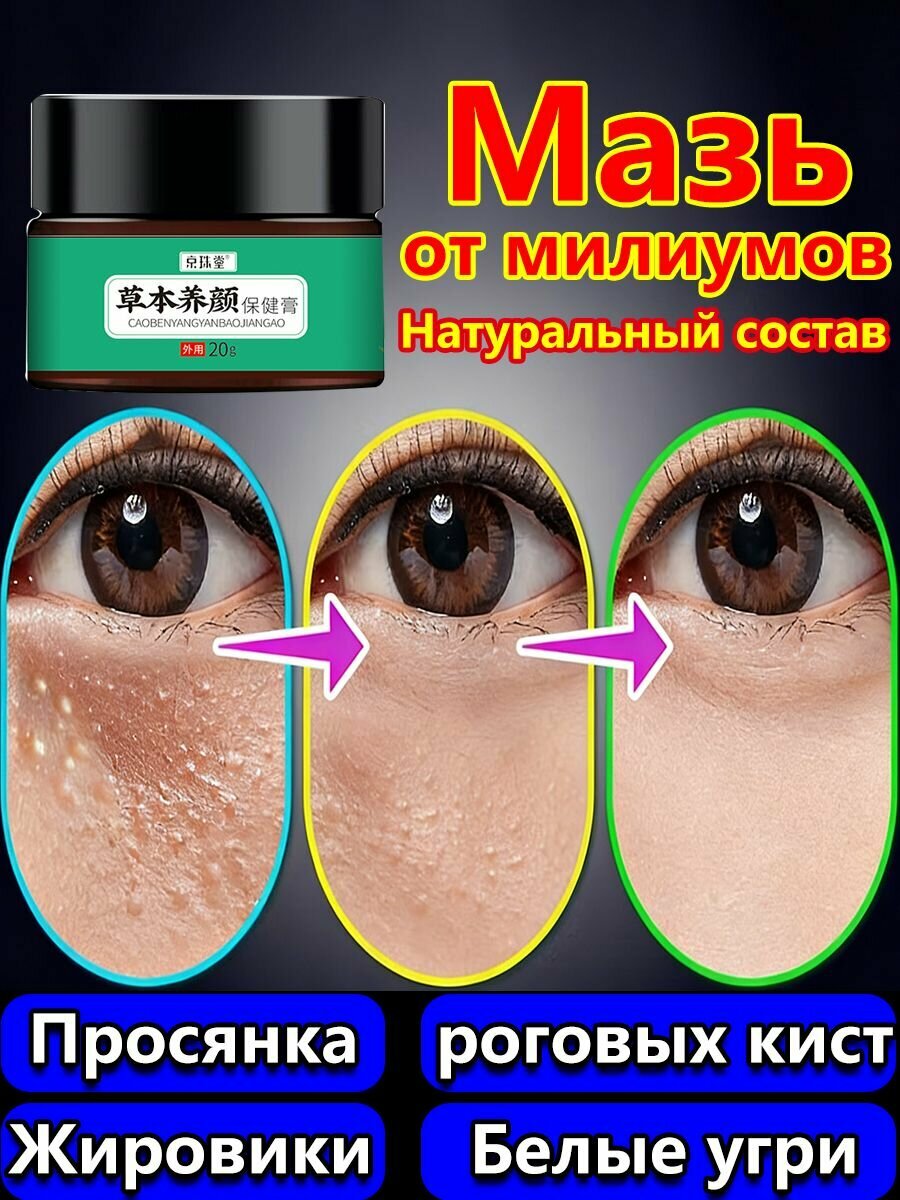 Мазь от милиумов от просянки белых угрей и роговых кист
