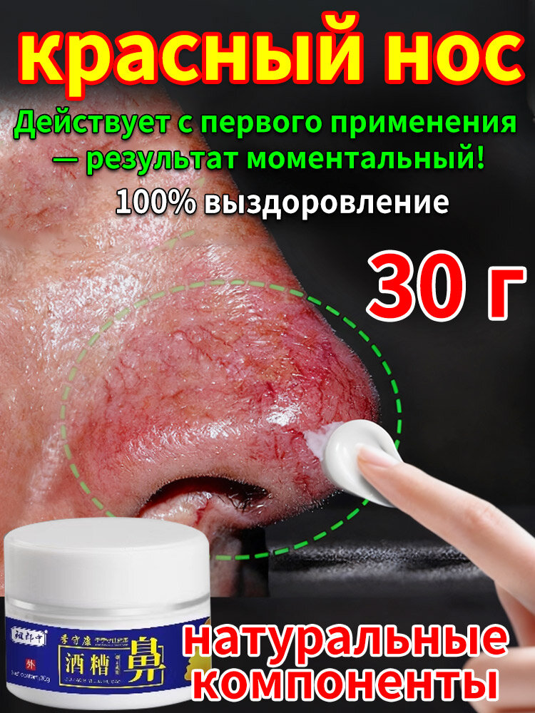 Мазь от розацеа и купероза, уменьшает покраснение и воспаление на лице, 30 г