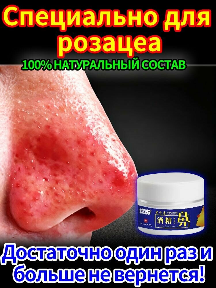 Мазь от розацеа и купероза, уменьшает покраснение и воспаление на лице, 30 г