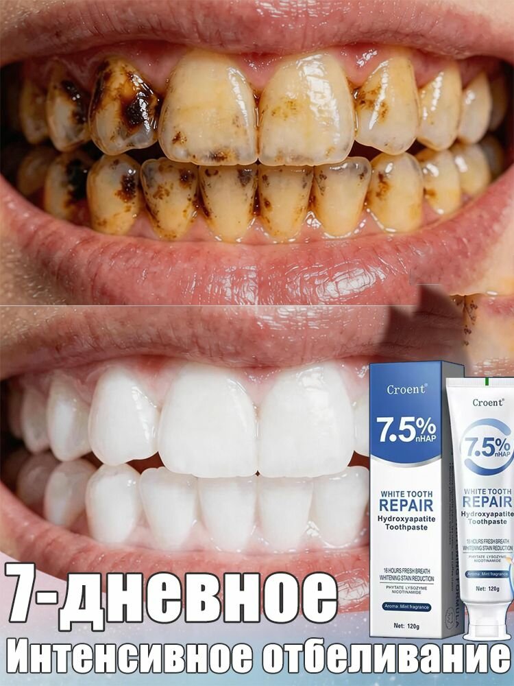 Мощная отбеливающая зубная паста для чувствительных зубов, отбеливание желтых зубов, удаление чайного и кофейного налета, Мягко и без раздражения 120 г
