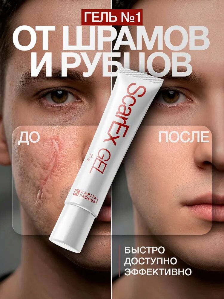 Гель от шрамов и рубцов Scarex / Крем от растяжек, от постакне, для осветления, восстановление, от ожогов, rejuvasil, силиконовый гель / 30 g