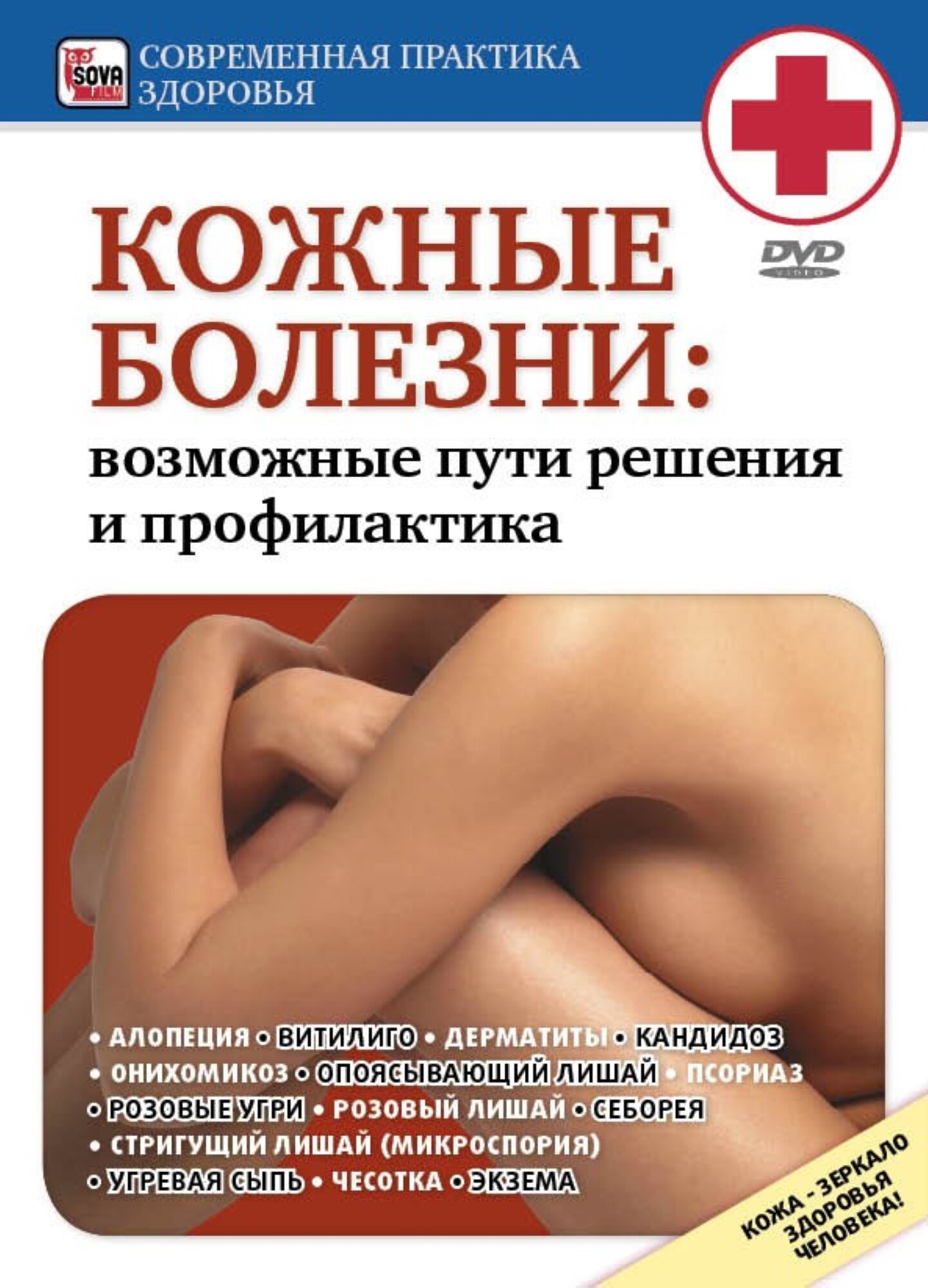 DVD-диск Кожные болезни - Возможные пути решения и профилактика (DVD)
