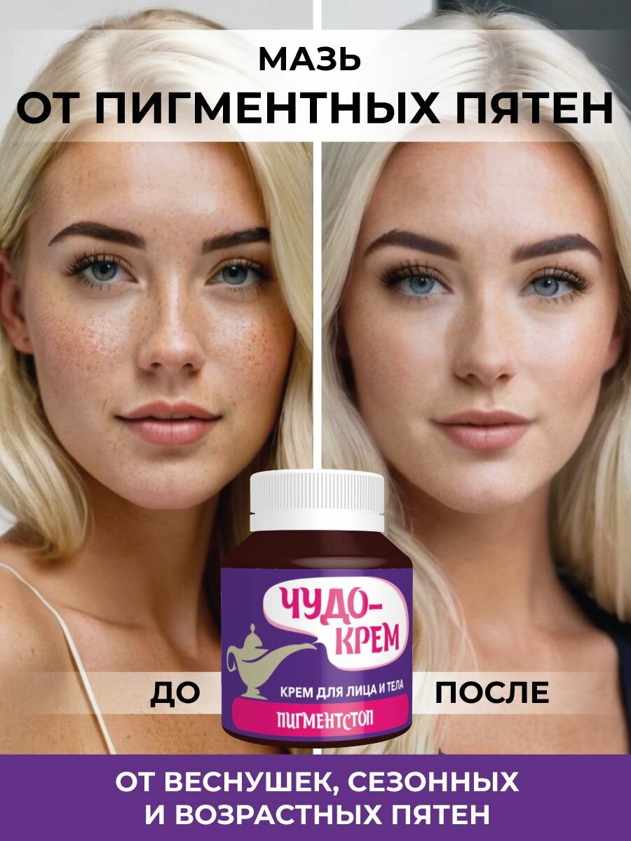 Крем от пигментных пятен для лица, отбеливание интимных зон и подмышек. Лучикс