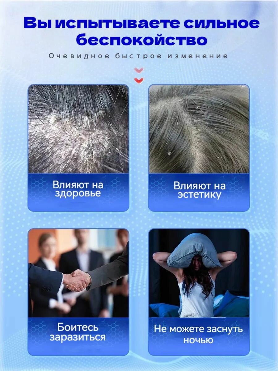 Крем от псориазадля лечения себорейного дерматита, зуда кожи и других кожных заболеваний, для кожи головы, тела и лица, 20 г