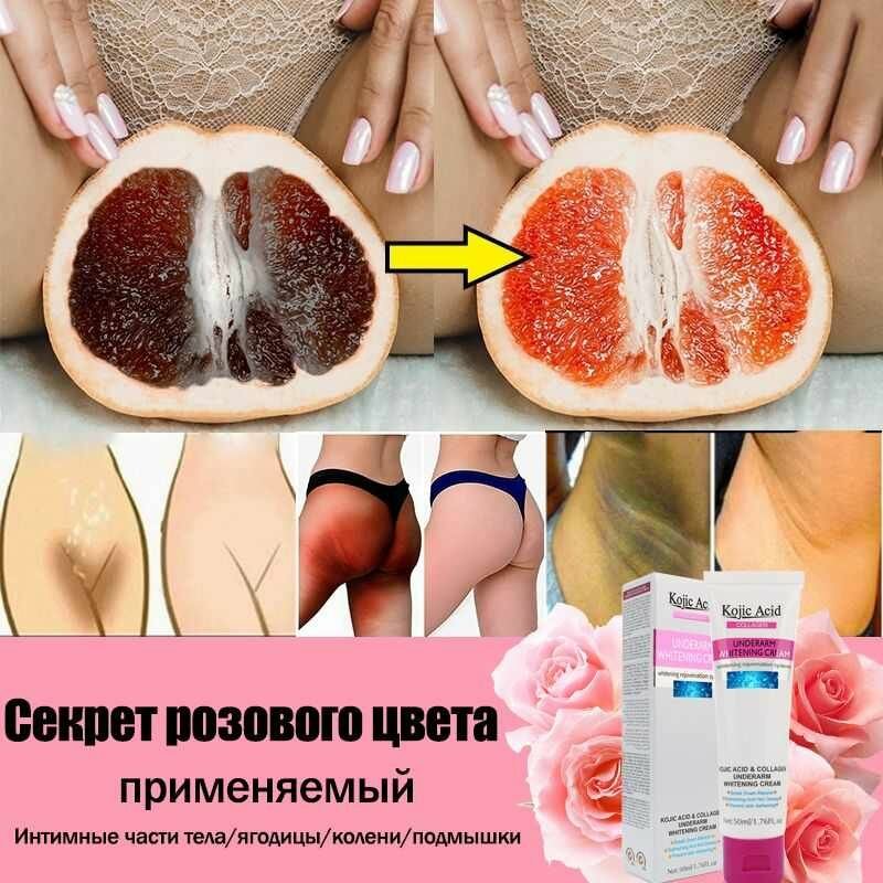 Крем для подмышек отбеливающий, Отбеливающий крем для тела, Для интимных зон, бедер, коленей, подмышек и локтей, против пигментации, омолаживающий /увлажняющий