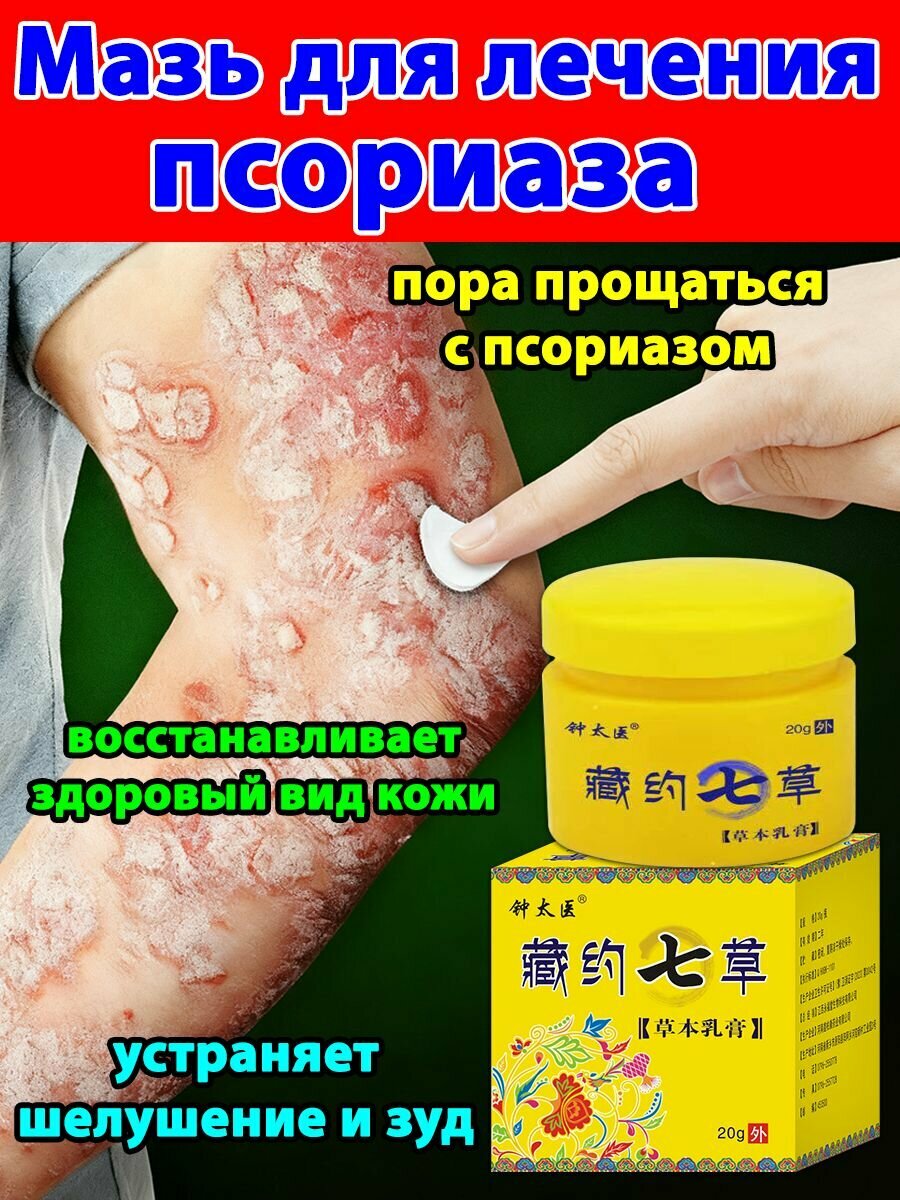 Китайская чудо мазь от псориаза и прыщей