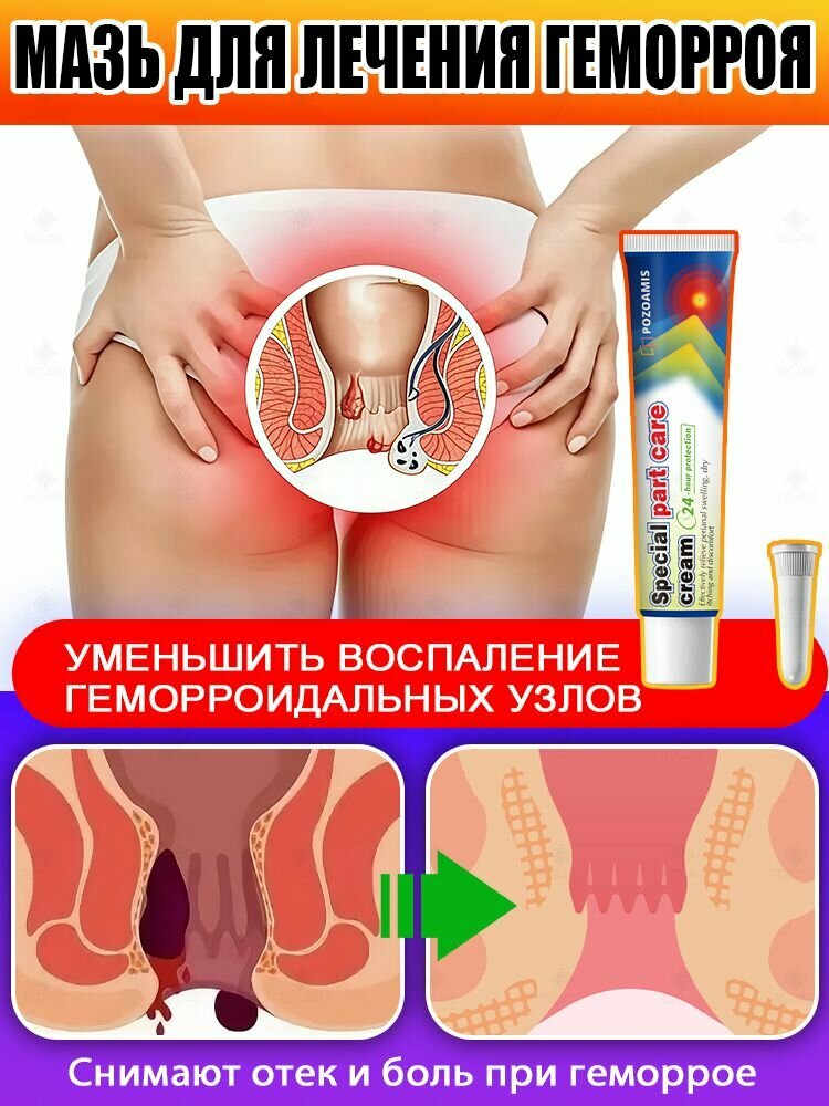 Мазь от геморроя,20 г. Быстрое обезболивание, Снимает воспаление, Убирает отек, эффективное Анальные трещины, Заживляет трещины. обезболивающая мазь противовоспалительная мазь противоотечная мазь средство для заживления трещин