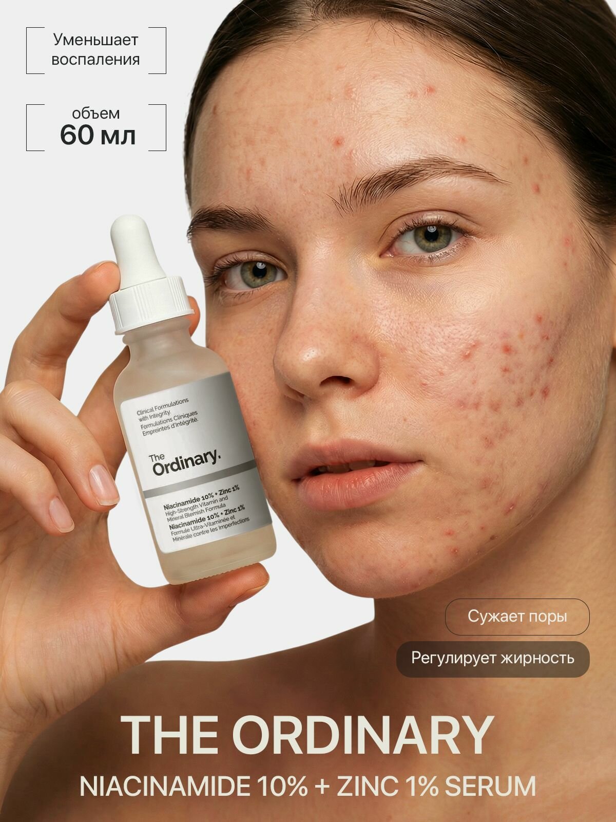 Сыворотка для лица от прыщей и акне The Ordinary Niacinamide 10% + Zinc 1%, против воспалений и жирной кожи, 60 мл