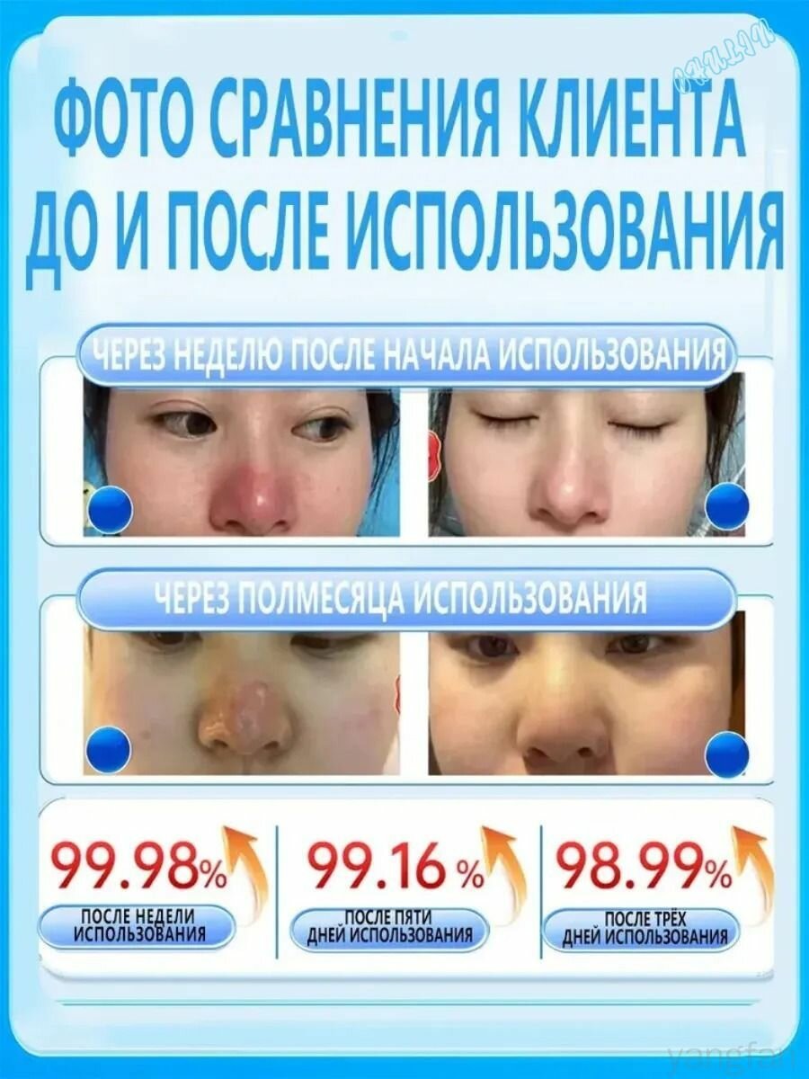 Популярный крем против купероза для чувствительной кожи лица, 30 г