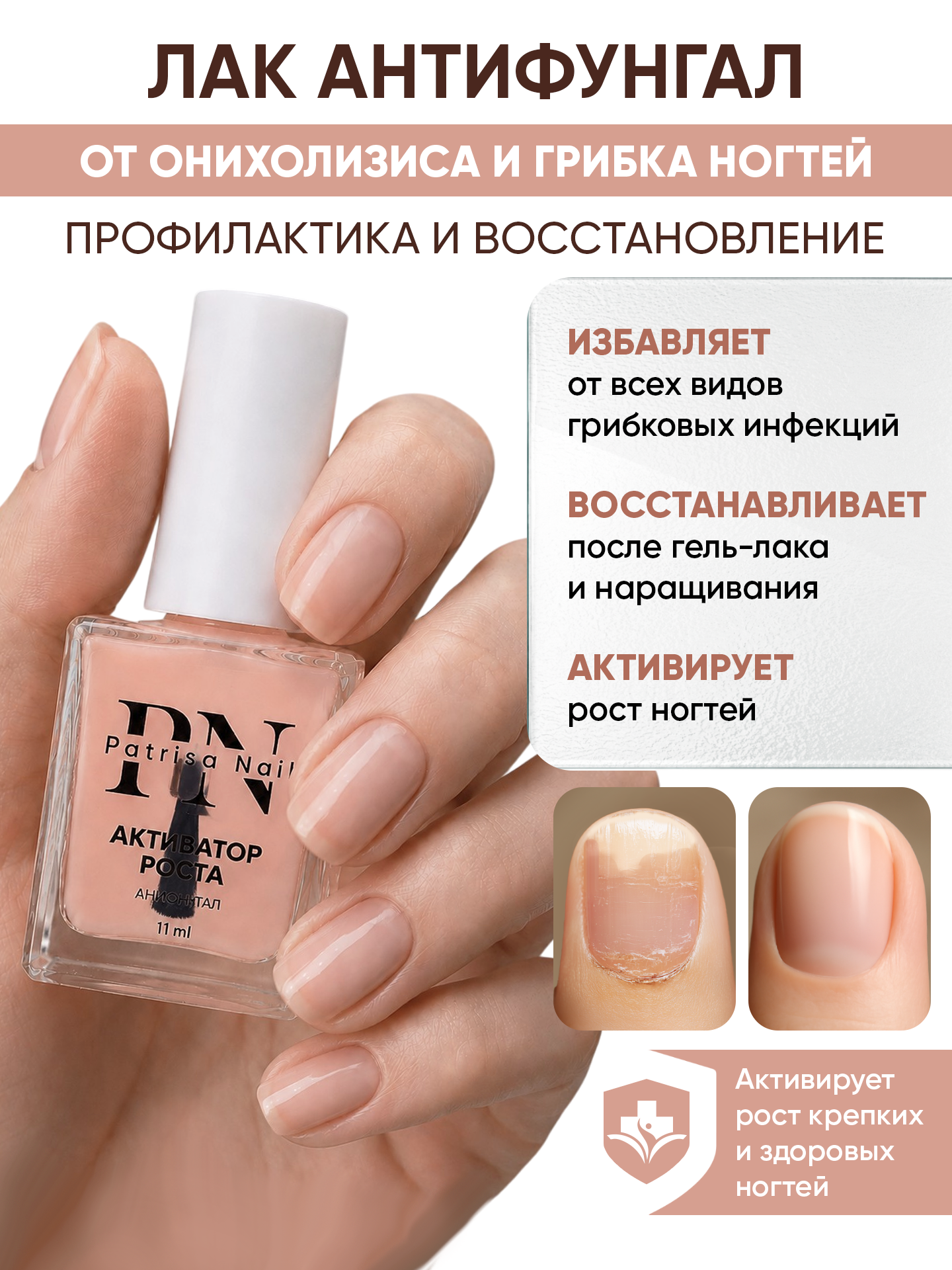 Лак для ногтей Активатор роста Антифунгал MicoStop от Patrisa Nail, 11 мл