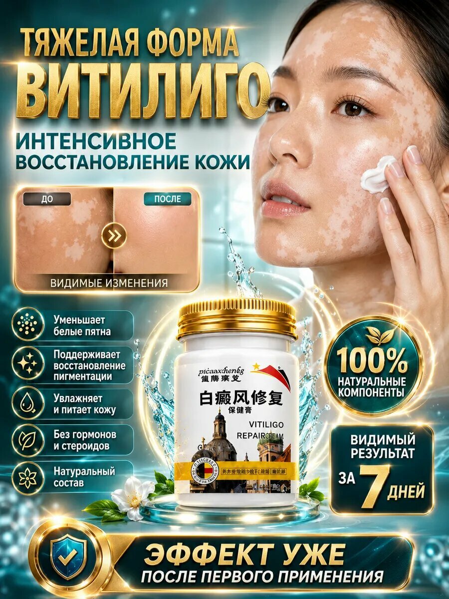 Anti vitiligo Мазь от витилиго китай 50г