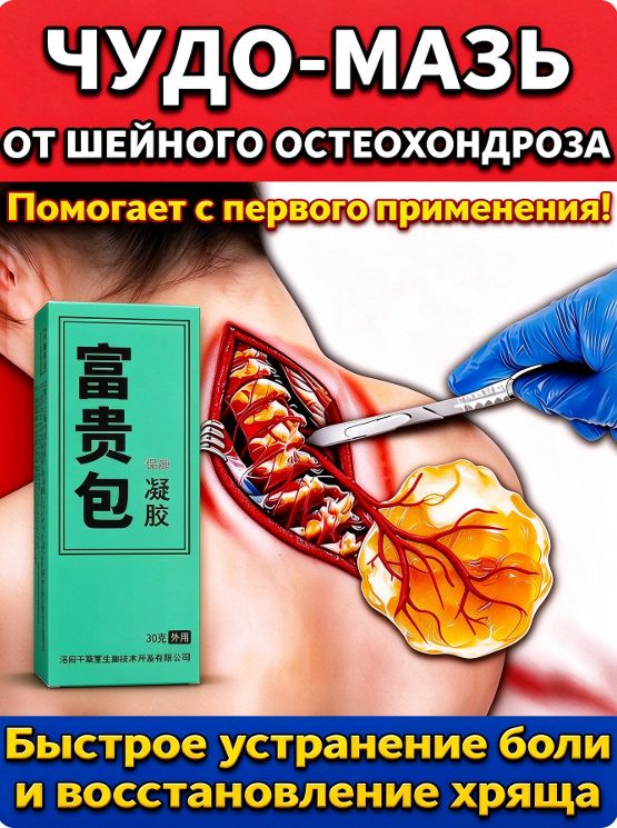 Устраняют жировые отложения, сдавливание нервов, боль и отек в области "вдовьего горба" на шее. Гель для лечения остеоартроза шеи и спины, 30 г.