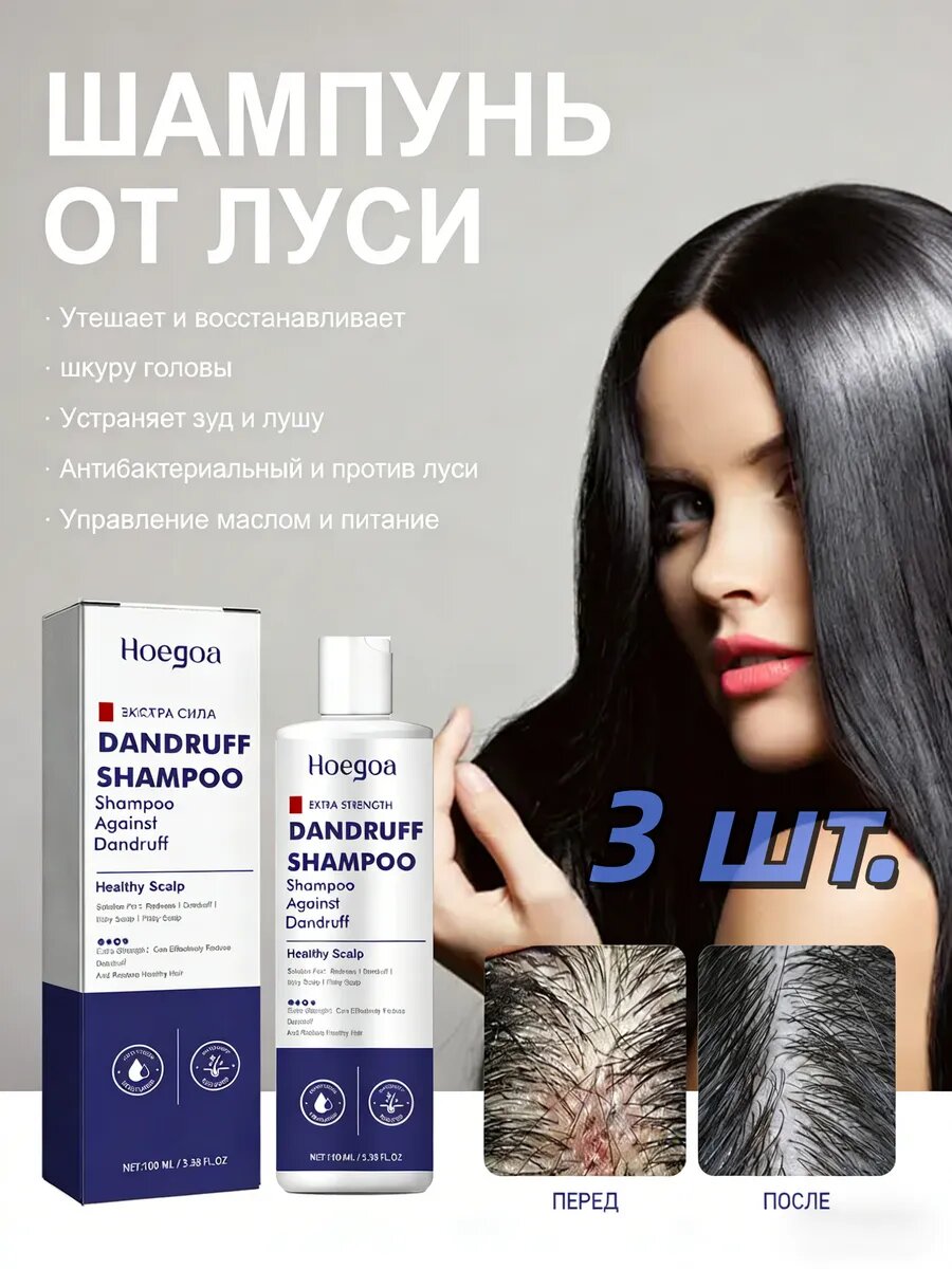 Шампунь против перхоти, уход за кожей головы, очищение и уменьшение зуда, растительные экстракты，3 шт.