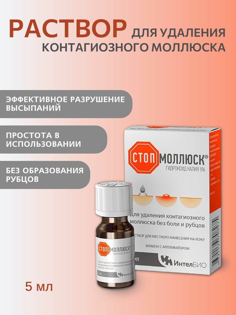 СтопМоллюск Раствор для удаления контагиозного моллюска / Средство от контагиозного моллюска, 5мл
