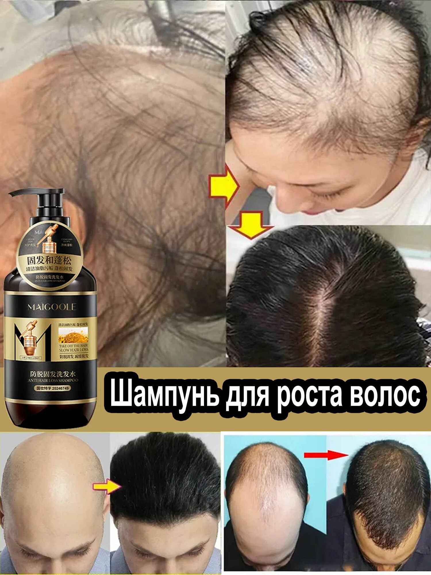 Шампунь для волос, 400 мл