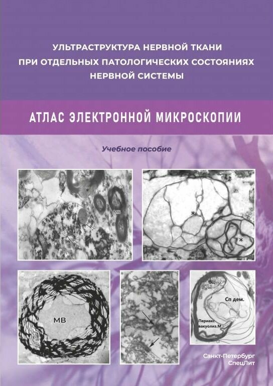 Ультраструктура нервной ткани при отдельных патологических состояниях нервной системы. Атлас электр