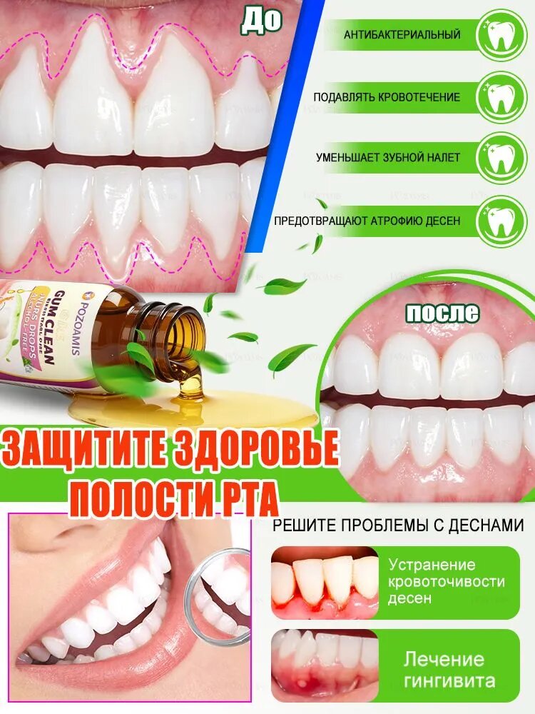 Используется для лечения пародонтита, стоматита, снятия чувствительности и отека десен, восстановления, профилактики и укрепления поврежденных десен, Гигиена полости рта.30 мл.