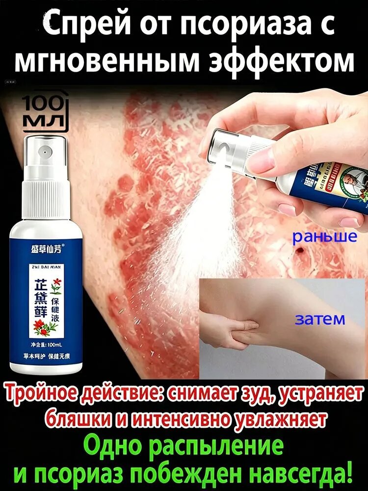 Зудайфу мазь от псориаза