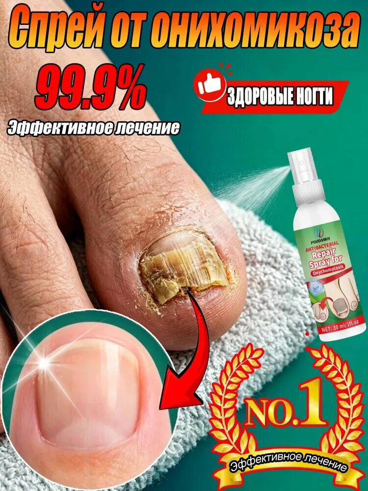 Полностью излечивает онихомикоз рук и ног, подавляет рост грибков и способствует здоровому росту ногтей.