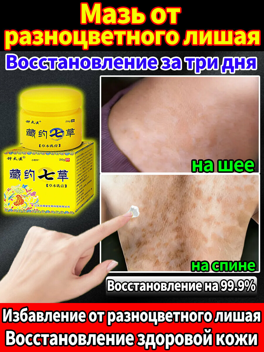 Эксклюзивное китайское средство от лишая восстанавливает здоровую кожу от лишая восстановление кожи