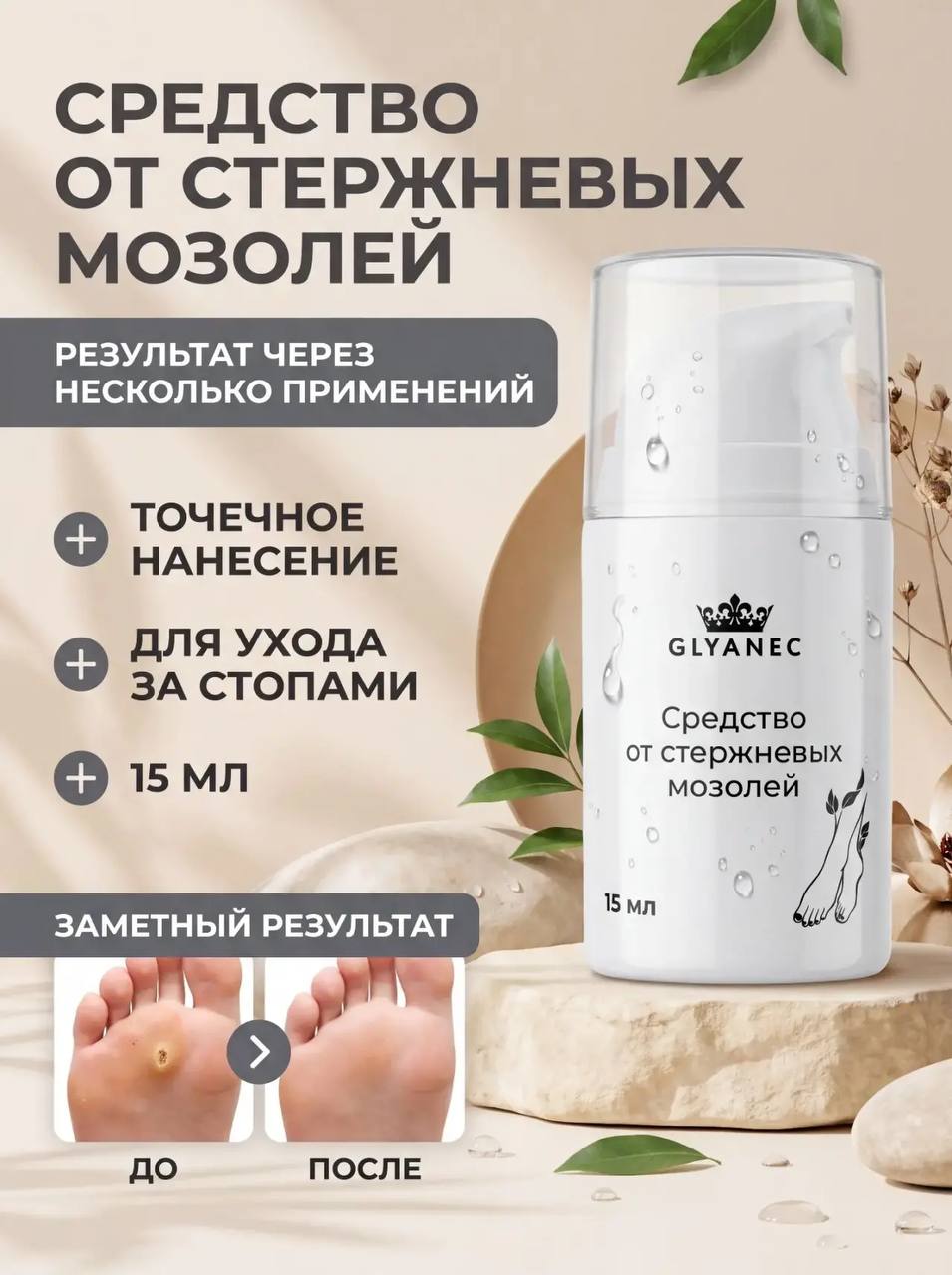 Средство от стержневых мозолей и натоптышей