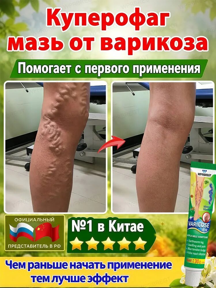 Крем от варикоза снимает отёки и тяжесть в ногах, укрепляет сосуды, уменьшает сосудистые звёздочки.
