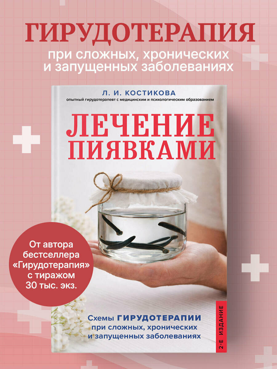 Костикова Л. И. Лечение пиявками. Схемы гирудотерапии при сложных, хронических и запущенных заболеваниях