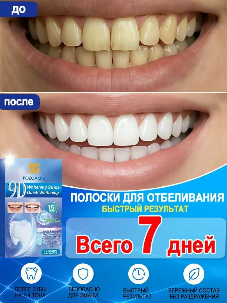 Отбеливающие полоски для зубов 9D. Быстро и эффективно удаляют зубной налет и желтизну. Безопасные и щадящие, подходят для чувствительных зубов, с заметным результатом. Содержит 14 полосок.