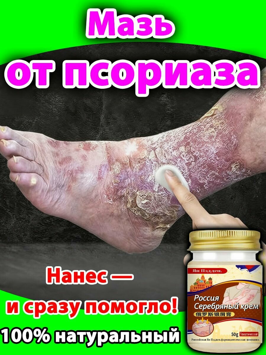 Крем мазь от псориаза от прыщей и дерматита экземы 50 мл